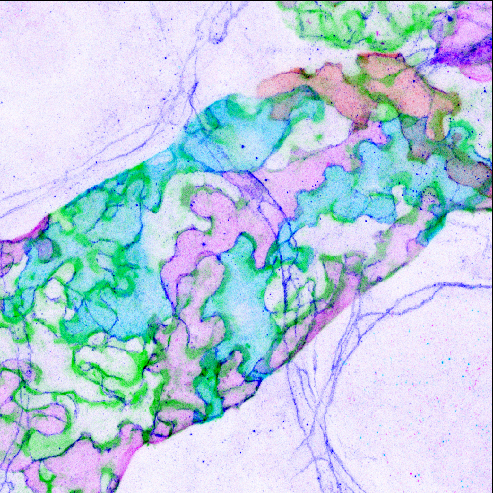 Wihuri Research Institute Symposium 2025 - Wihuri Research Institute